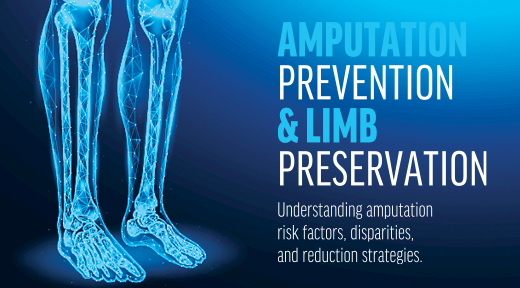 Amputation Prevention & Limb Preservation - Endovascular Today